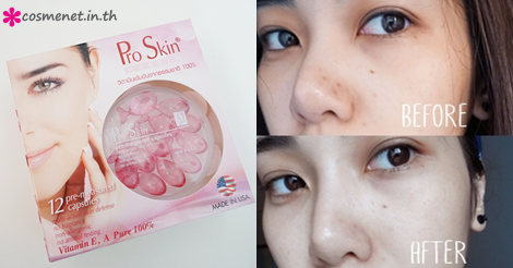 Cosme*Review วิตามินครอบจักรวาล Pro Skin Vitamin