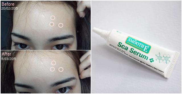 Cosme*Review Smooth E Smooth Sca Serum Advanced Formula (Face and Body)